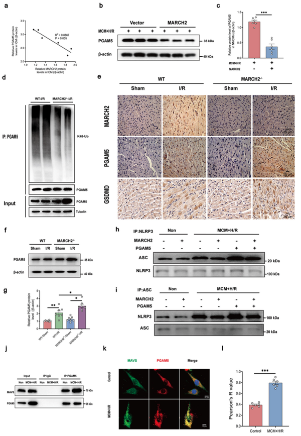 Cell Discovery丨IF：33.5丨MARCH2通过抑制焦亡从而保护心肌缺血再灌注损伤 - 知乎