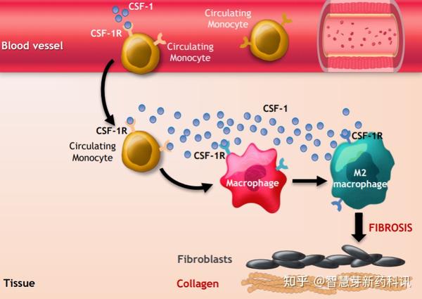 调节肿瘤免疫抑制，新一代CSF-1R抑制剂在癌症治疗中疗效可喜！ - 知乎