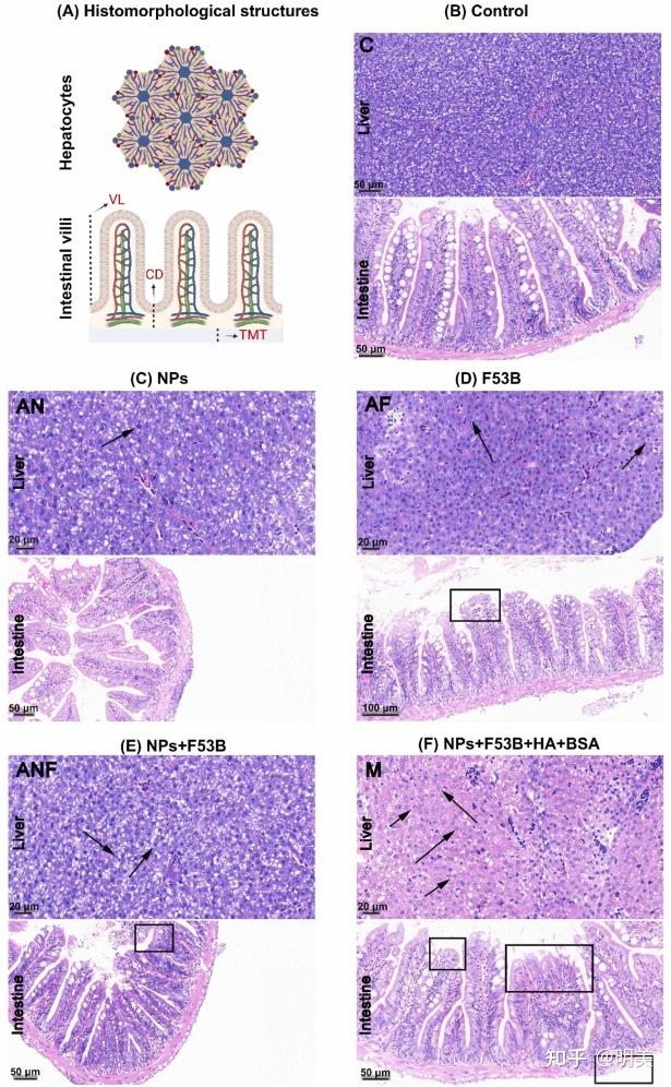 【科研前沿】华南农业大学使用明美数字切片扫描仪MDS4揭示纳米塑料与污染物协同毒性机制！ - 知乎