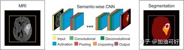 Deep Learning for Brain MRI Segmentation: State of the Art and Future ...