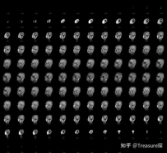 ImageJ实用教程——3D Stack Reslice(基本功能篇) - 知乎