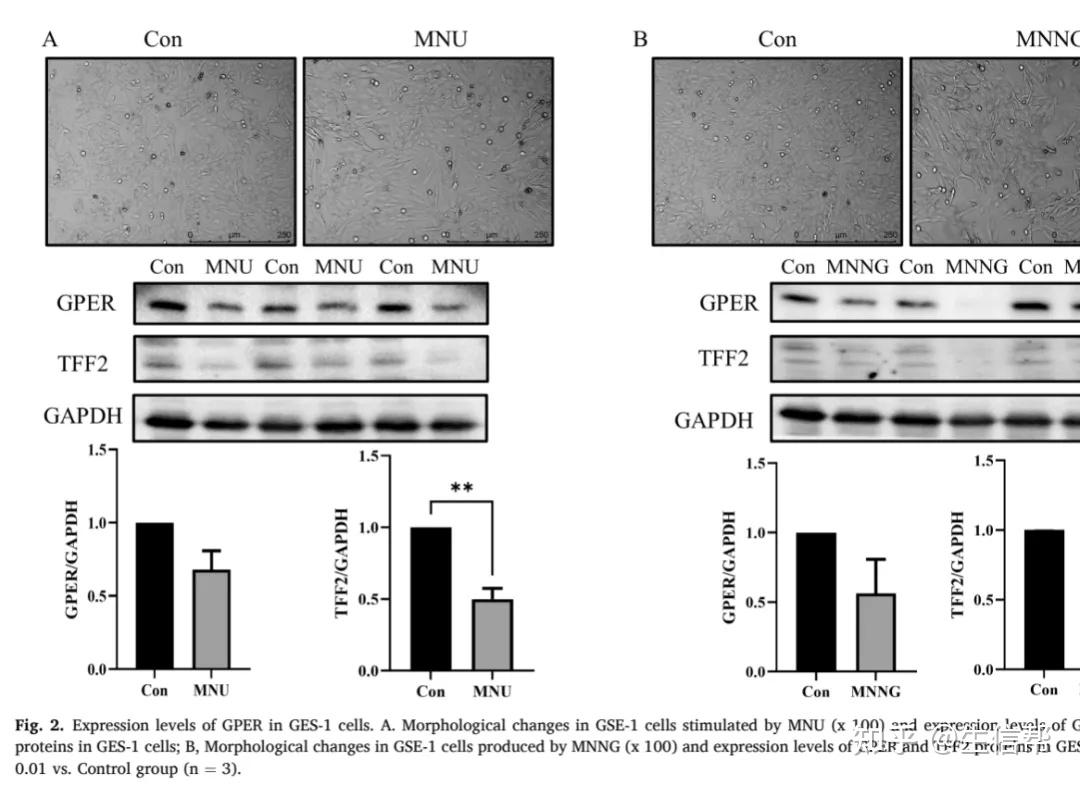 【单基因套路】单基因与泛癌结合研究单一癌症的免疫浸润，换个癌照样发 - 知乎