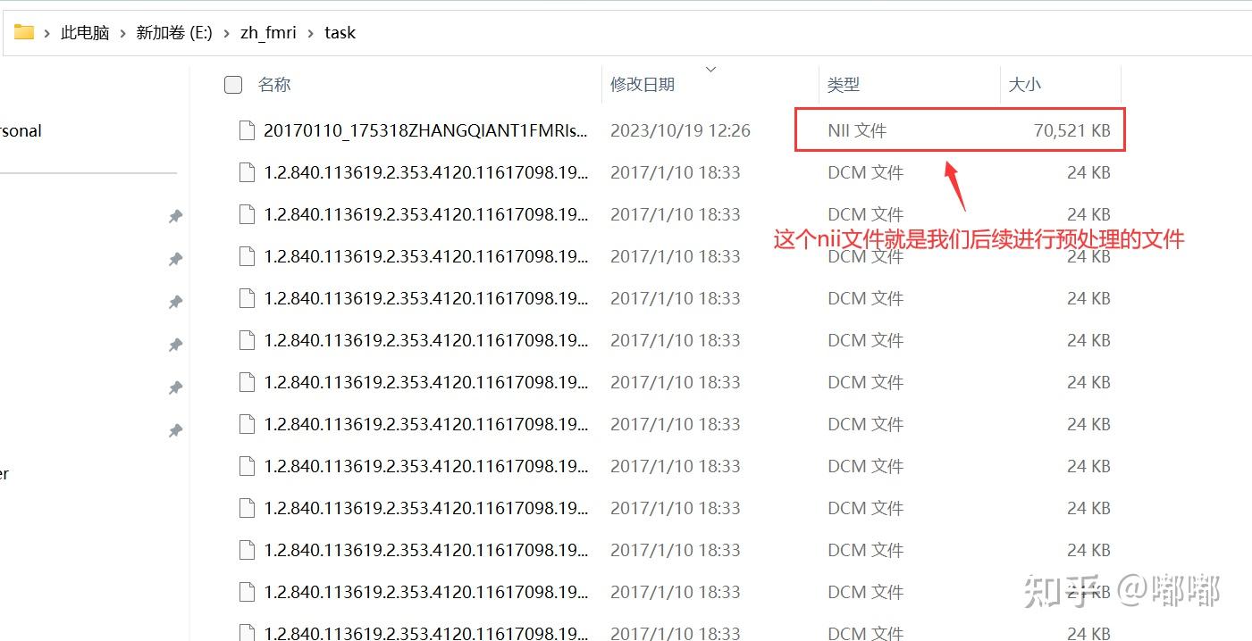 1-spm-fMRI任务态数据处理——格式转换 - 知乎