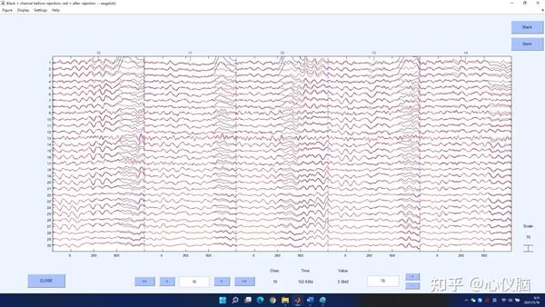 无需代码！图文并茂详解EEGLAB中的ERPs数据分析方法 - 知乎