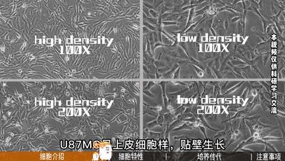 U87MG细胞培养，人恶性胶质母细胞瘤细胞培养攻略 - 知乎