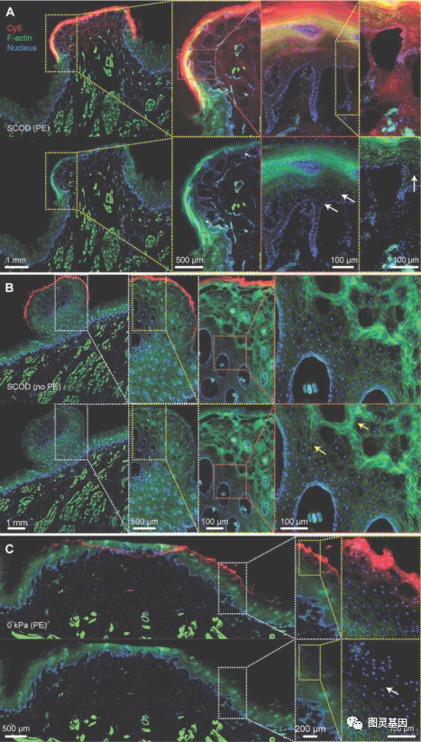 Sci Tra Med | 章鱼吸盘启发的贴片打破药物输送障碍 - 知乎