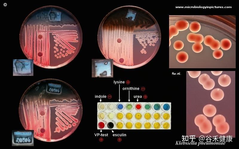 全面认识——肺炎克雷伯菌 （Klebsiella pneumoniae） - 知乎
