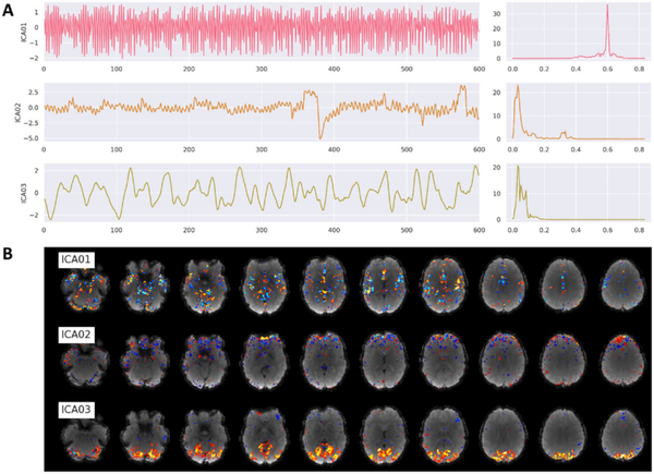 fMRIflows：全自动单变量和多变量fMRI处理管道的联合体 - 知乎