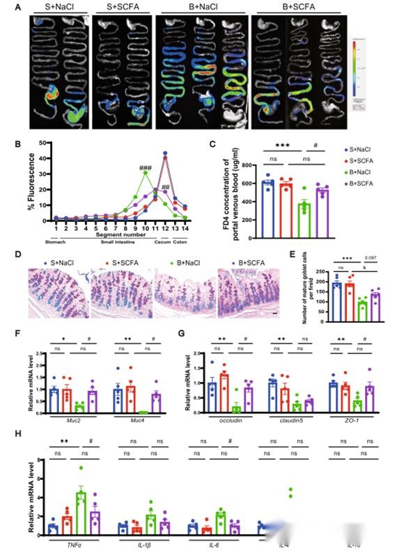 Microbiome | 微生物-肠道-脑轴通过干扰短链脂肪酸的代谢参与慢性脑灌注不足慢性脑灌注不足 - 知乎
