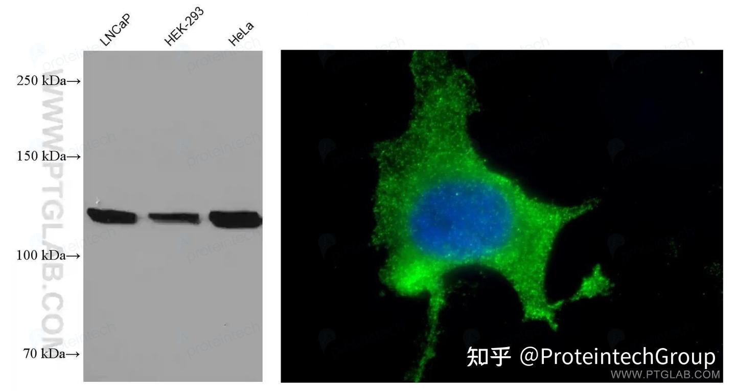WB指南 | 18种常用WB内参大盘点！码住！ - 知乎