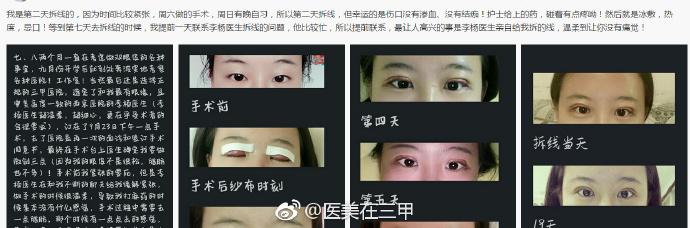 西京医院 【李杨】医生案例分享 - 知乎