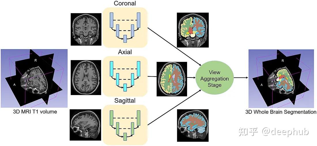 医学图像的深度学习的完整代码示例：使用Pytorch对MRI脑扫描的图像进行分割 - 知乎
