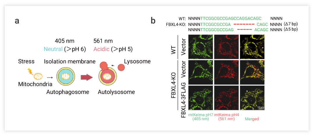 超详细 | 线粒体自噬机制及检测方法大汇总 - 知乎