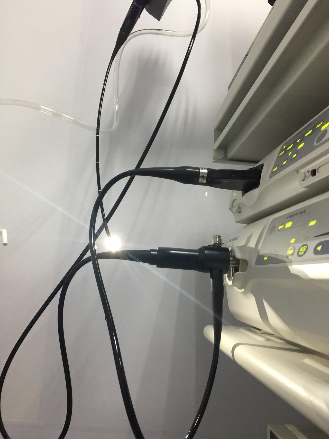 做过喉镜的人能来说下吗？你们做的时候难受吗？什么感觉？ - 知乎