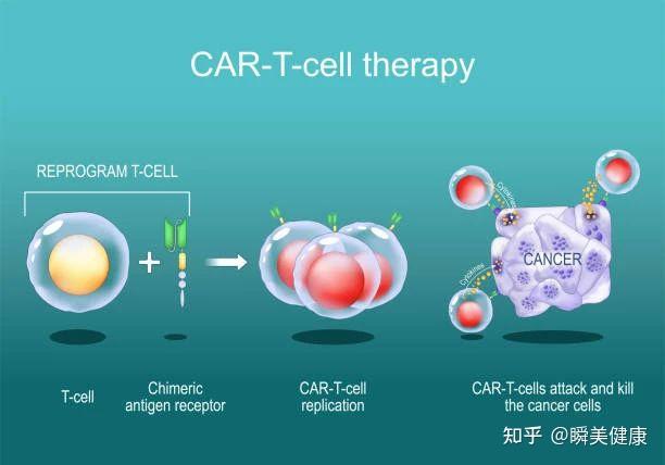 明星案例｜李开复成功抗癌9年后的今天，免疫细胞疗法已让75%淋巴瘤患者实现完全缓解！ - 知乎