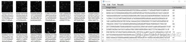 ImageJ实用教程——StarDist批量细胞计数(案例分析篇) - 知乎