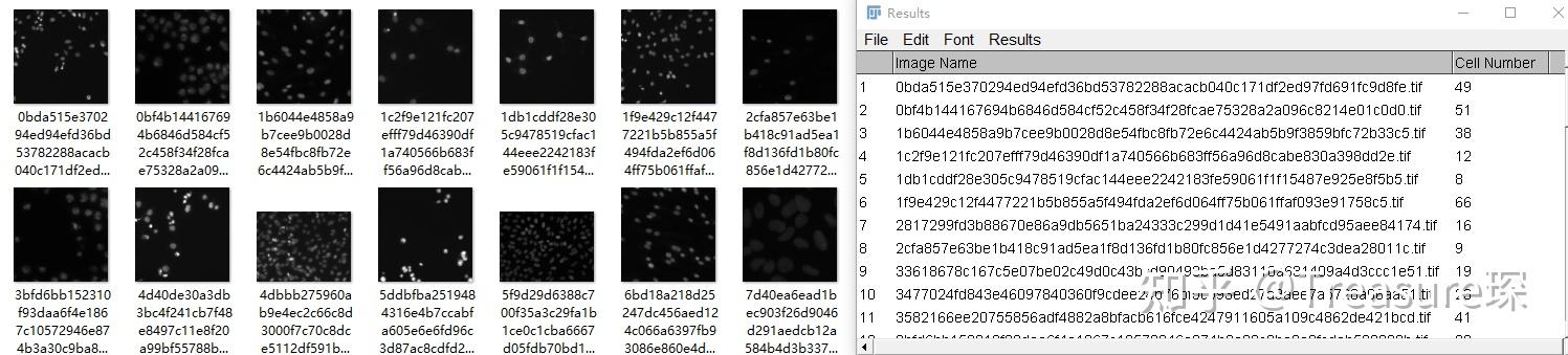 ImageJ实用教程——StarDist批量细胞计数(案例分析篇) - 知乎