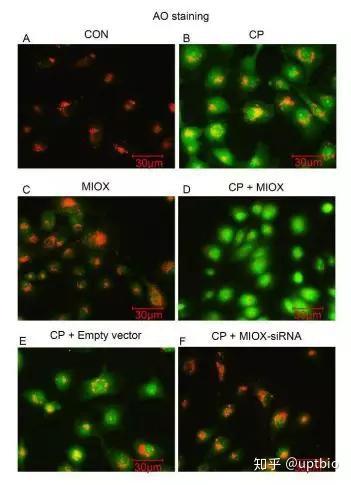 细胞病理性铁死亡？中科院一区带你探索MIOX的妙用 - 知乎
