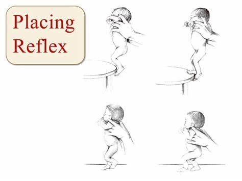 儿康笔记——粗大运动发育之原始反射 - 知乎