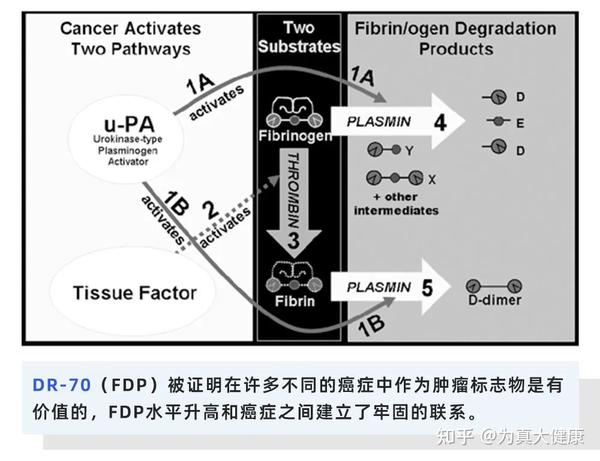 癌症晴雨表DR-70 - 知乎
