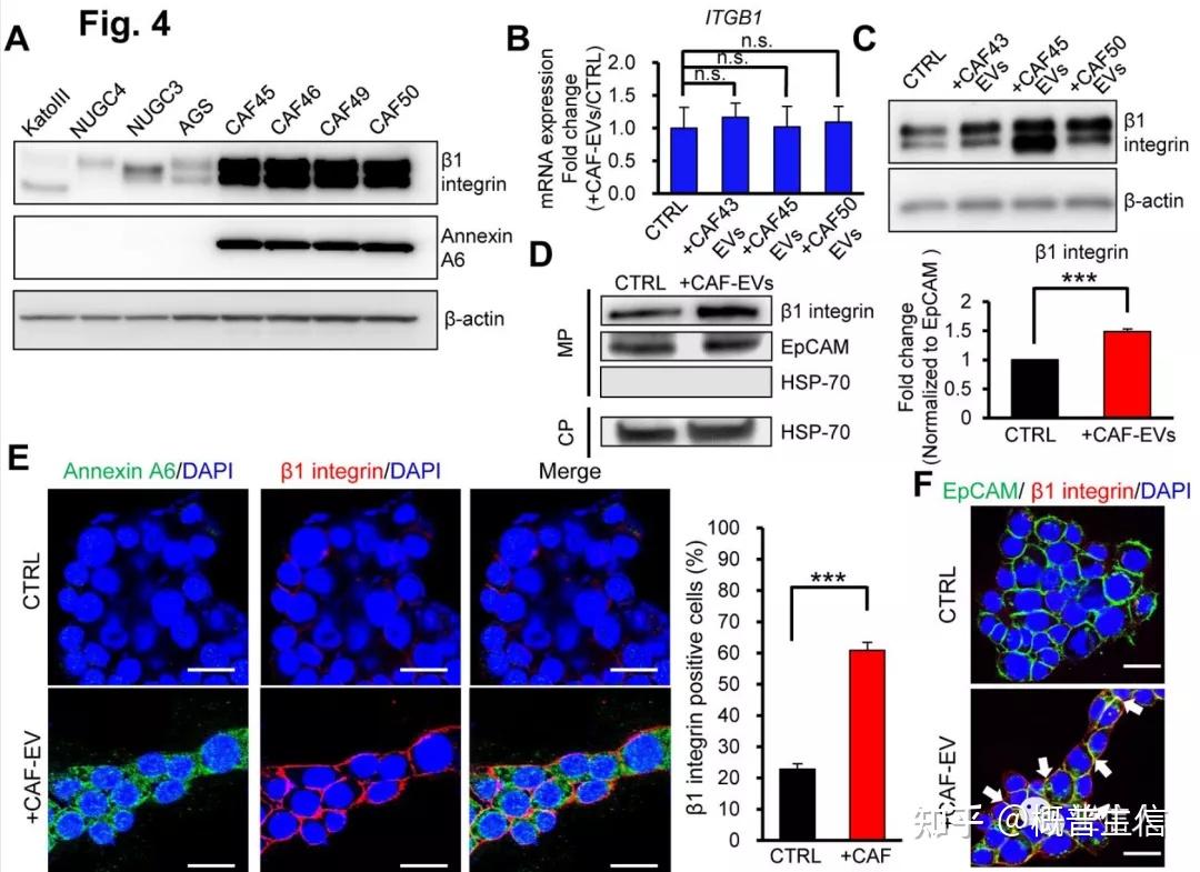 火爆全网的癌症相关成纤维细胞(CAF)最全面总结 - 知乎