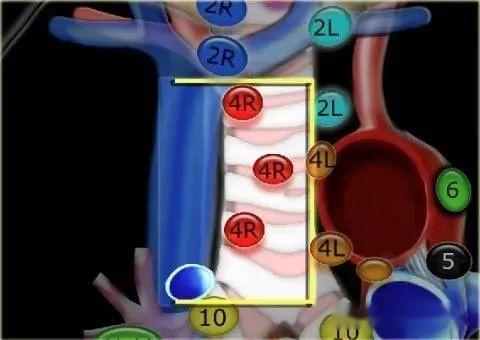 纵隔淋巴结的分区(IASLC)与诊断 - 知乎
