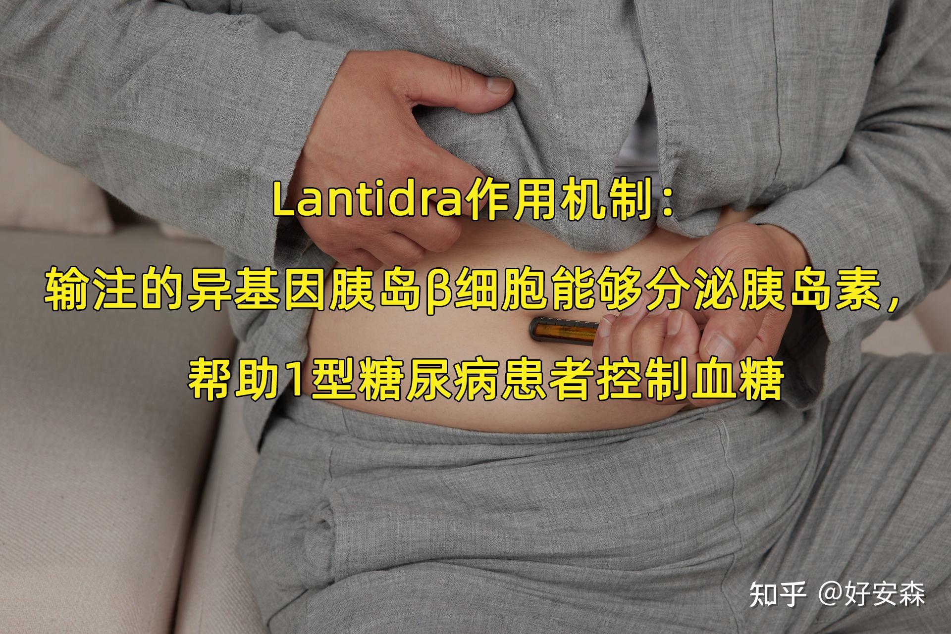 美国批准首个1型糖尿病细胞疗法，多名受试者5年不用注射胰岛素！ - 知乎
