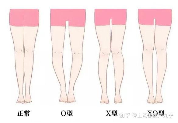 如何让腿变直? 知乎