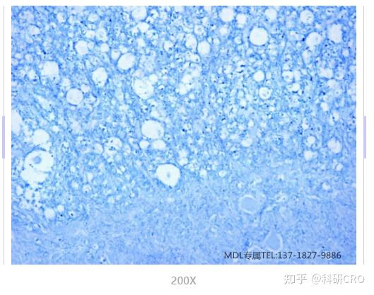 快速掌握一种染色实验方法——LFB髓鞘染色法！ - 知乎