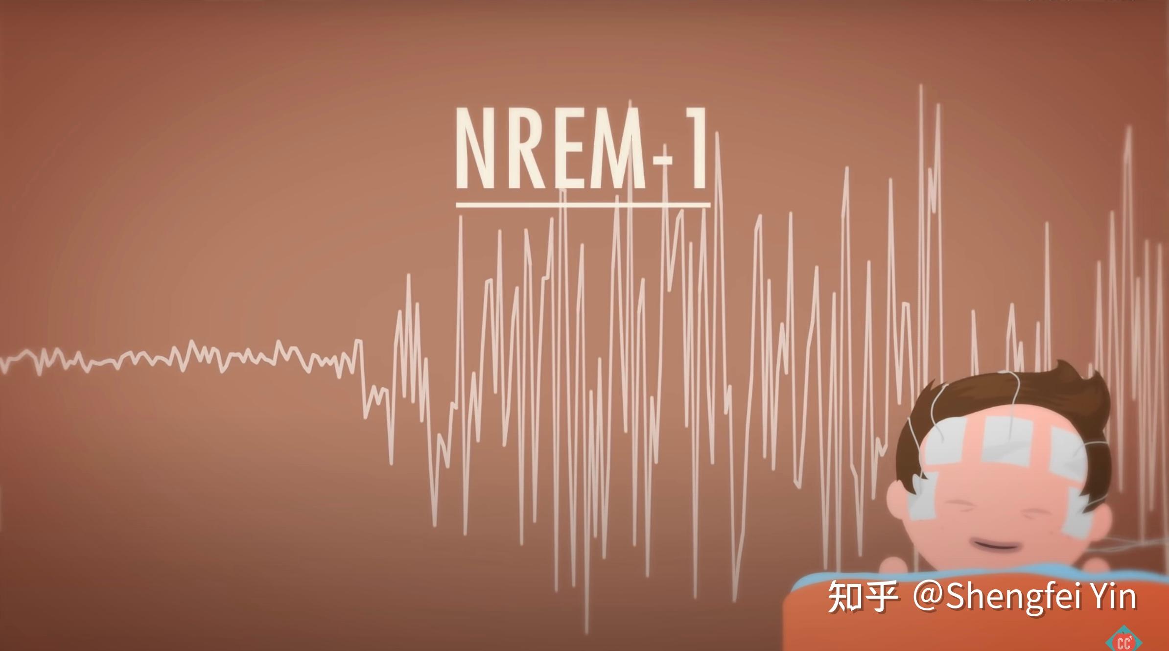 Sleep & Dreams - Crash Course Psychology #9 - 知乎