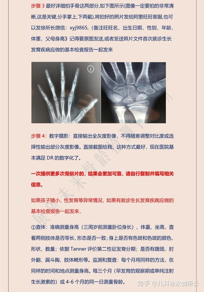 一分钟图解中华05标准CHN法tw3法骨龄鉴定原理与重要性 - 知乎