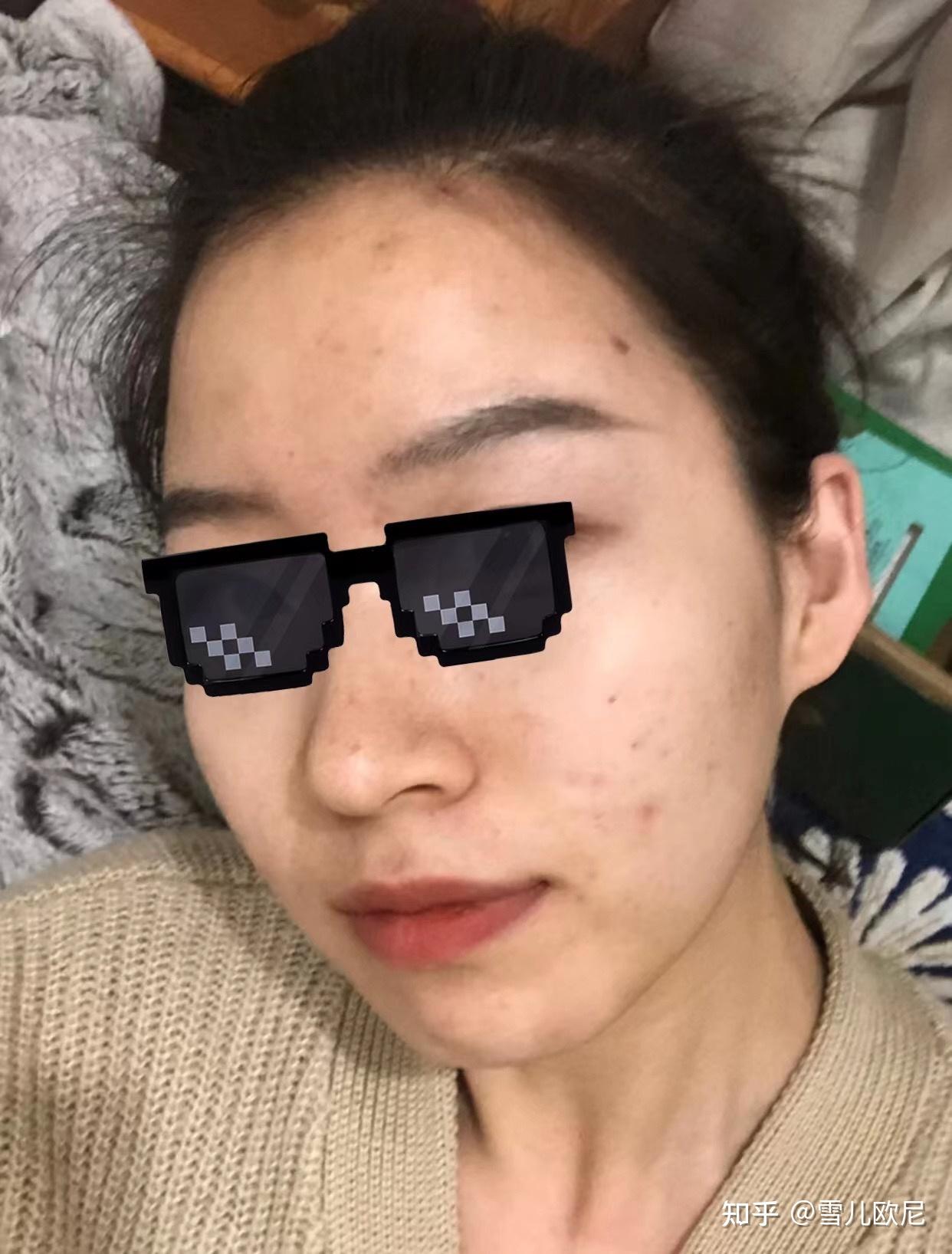 快来看~~快来看啊~ 祛痘印界的扛把子!! 买到就是赚到啊 知乎