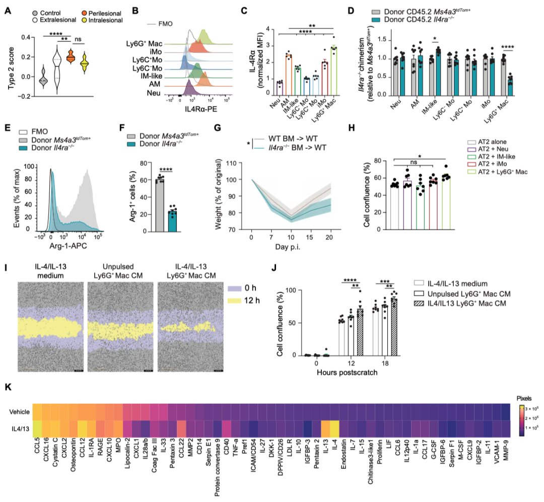 Science Immunology丨肺损伤后招募的非典型 Ly6G+巨噬细胞增强肺泡再生 - 知乎