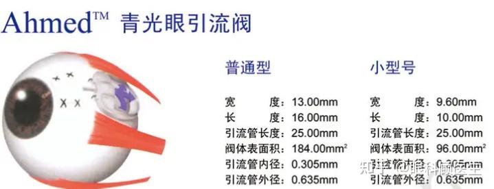 了解Ahmed青光眼阀植入术 - 知乎