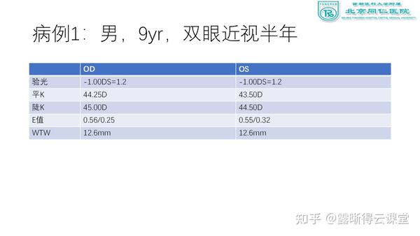 角膜地形图解读及露晰得塑形镜验配要点（文字版） - 知乎
