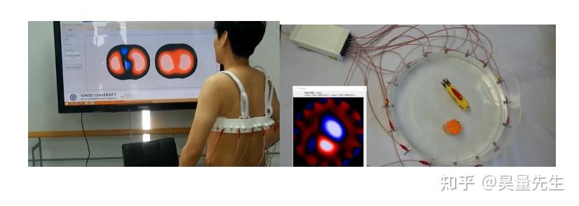 胸阻抗断层成像仪临床前解决方案—Sciospec Lung EIT Kit - 知乎