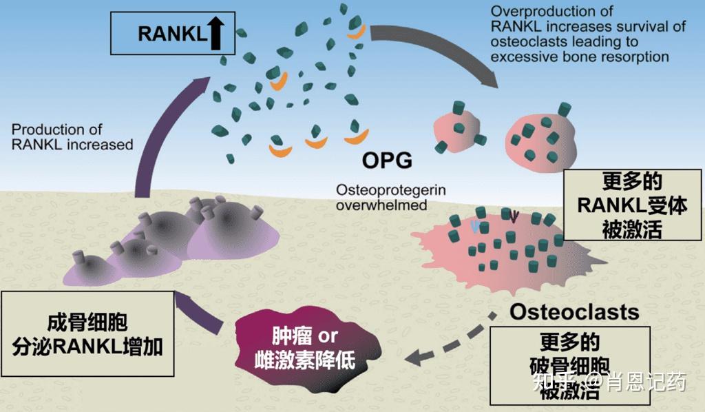 如何记住所有FDA批准生物药？| RANKL拮抗剂 | 普罗力®安加维®地舒单抗| 降低骨质疏松等相关骨事件 - 知乎