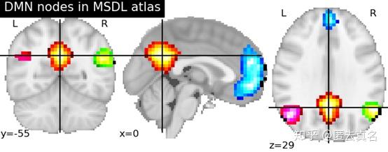 Nilearn：基于Python语言神经成像的机器学习（4） - 知乎