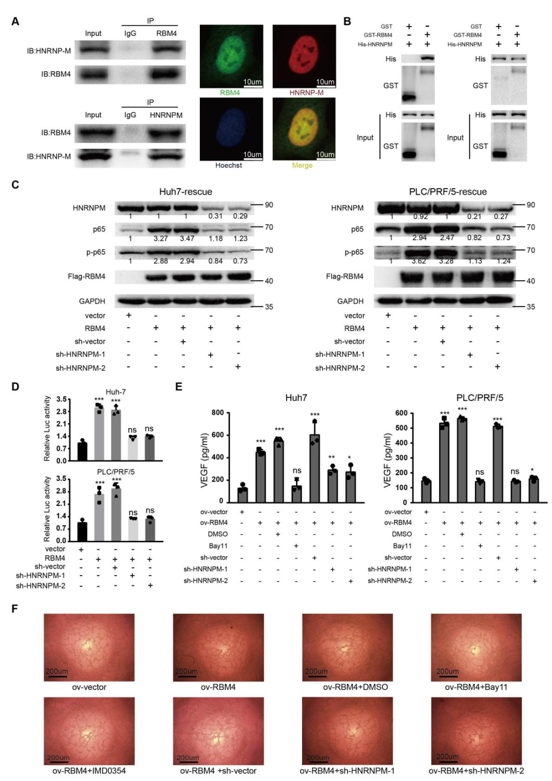Pharmacol Res | 周国雄/叶军团队研究发现RBM4通过选择性激活VEGF-A的表达来促进肝癌中的血管生成 - 知乎
