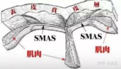 什么是SMAS筋膜层？位置在哪？有哪些抗衰效果？ - 知乎