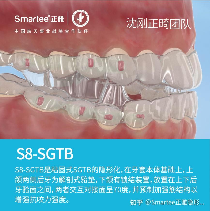 正雅答疑丨S8-SGTB与S8-SGHB的共同点和区别是什么？ - 知乎