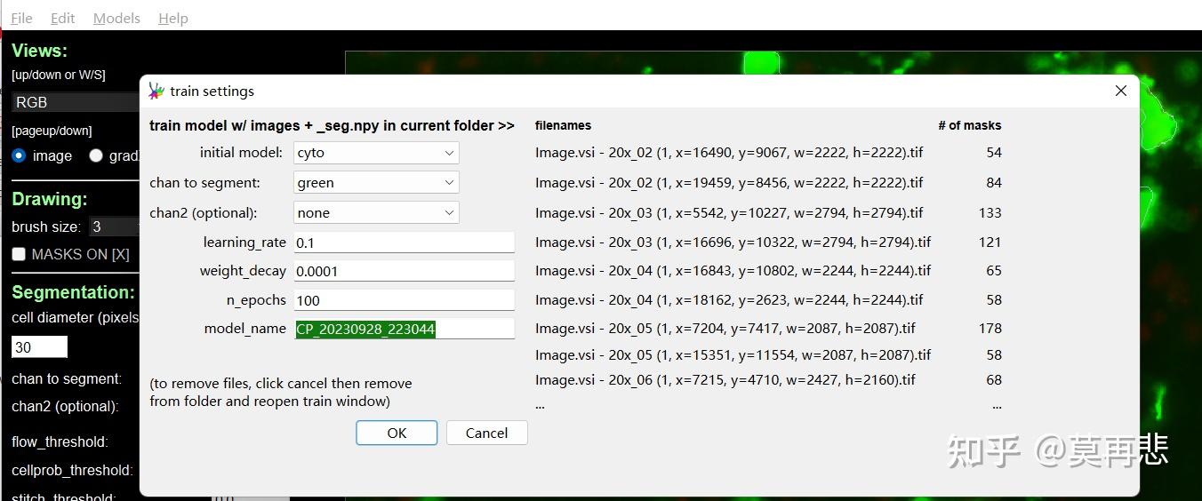 从零开始描述不规则细胞——基于cellpose（2.0）与stardist（qupath）的自动细胞分割及计算教程 - 知乎