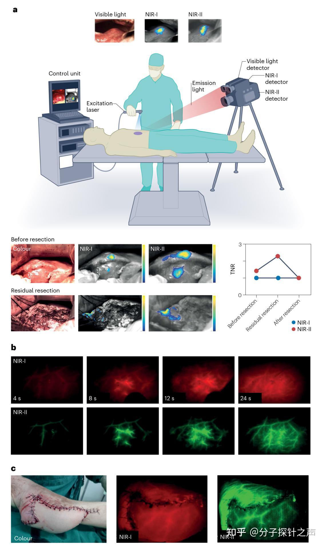 Nat. Photonics: 活体NIR-II荧光成像在生物和医学的应用 - 知乎