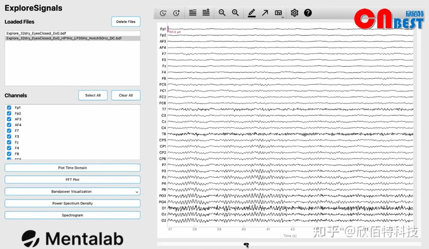 Mentalab Explore 开源 EEG 软件方案：构建开放兼容的脑电研究生态 - 知乎