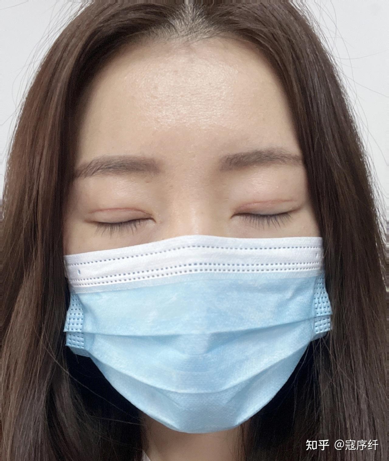 双眼皮day 29 - 知乎