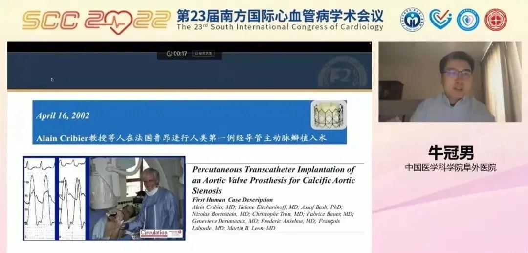 吴永健教授团队：主动脉瓣疾病TAVR治疗向“简”而行 - 知乎