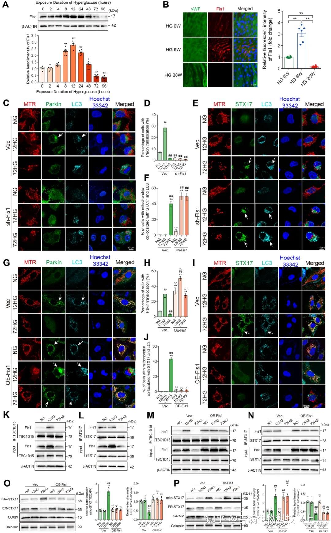 Advanced Science | STX17介导的线粒体自噬切换加剧糖尿病血管损伤 - 知乎