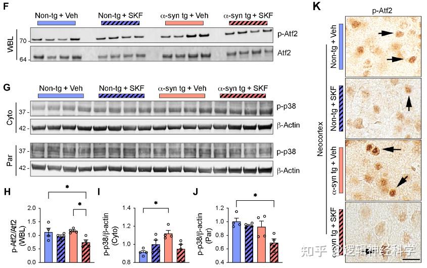 STM︱路易体痴呆/帕金森病小鼠模型中抑制p38αMAPK可修复神经元p38γMAPK并改善突触变性 - 知乎