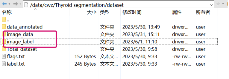 nnunet v2训练自己的数据集 - 知乎
