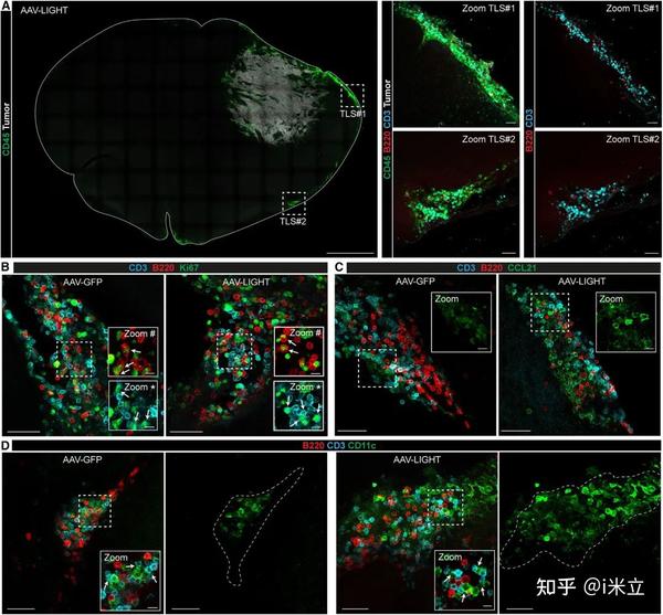 IF:38.585|通过AAV疗法调整血管表型可促进神经胶质瘤的抗肿瘤免疫 - 知乎